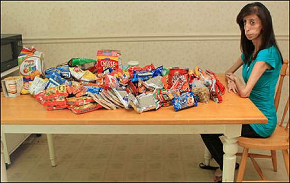 Aneh2 dan Unik2: Inilah Wanita Terkurus Di Dunia [Pic Inside]