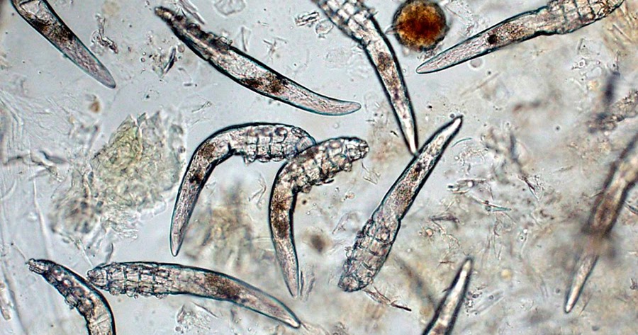 VOGUE COIFFURE HAIR STUDIO SDN BHD ( MALAYSIA ) : human demodex