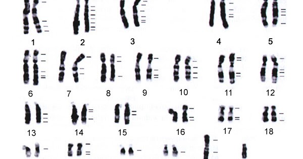Cosa Vuol Dire Aploide e Diploide? Qual è la Differenza tra Organismi ...