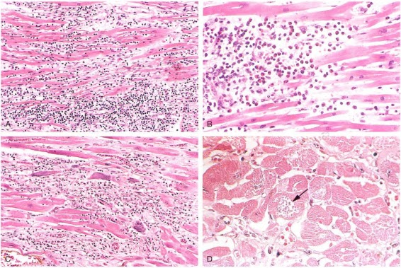 Portafolio Patología B