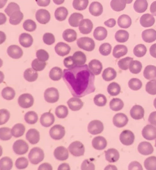 Cindy's Lab Life: It's LOVE through the microscope