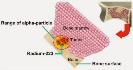 PSA 2640: RA-223 Xofigo
