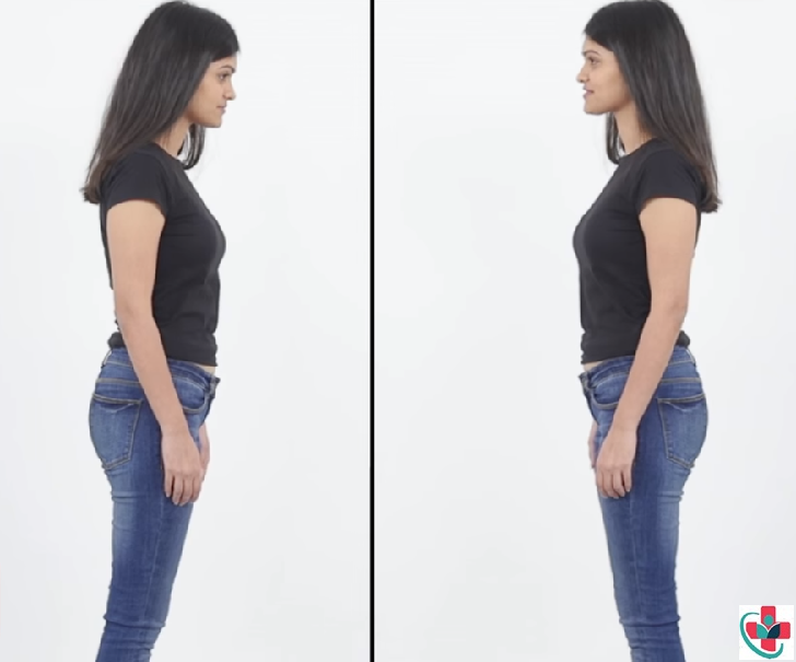 6 Common Posture Mistake by Women and How to Correct Them
