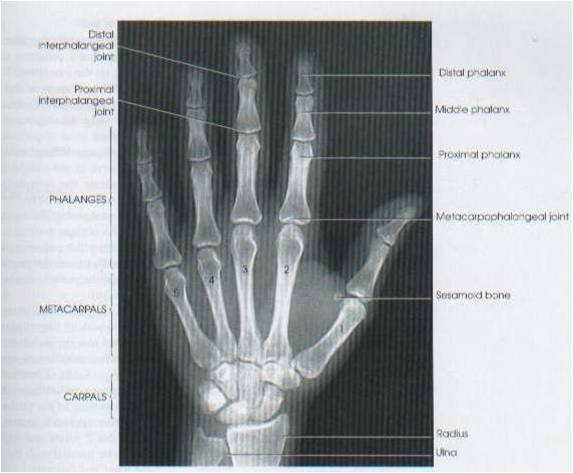 BLOG RADIOGRAFER: TEKINIK RADIOGRAFI OSSA MANUS