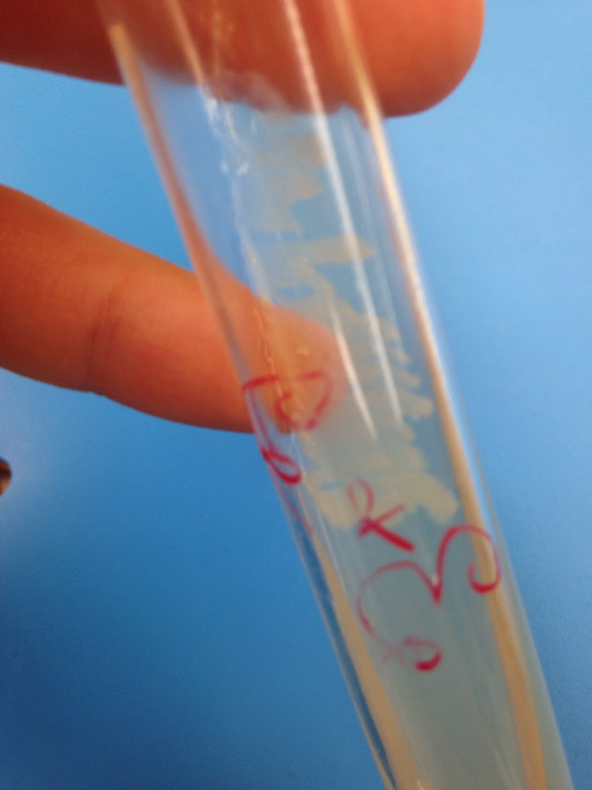 Microbiology Mania: Transfer of Unknown from Streak Plate to Slant Tube ...