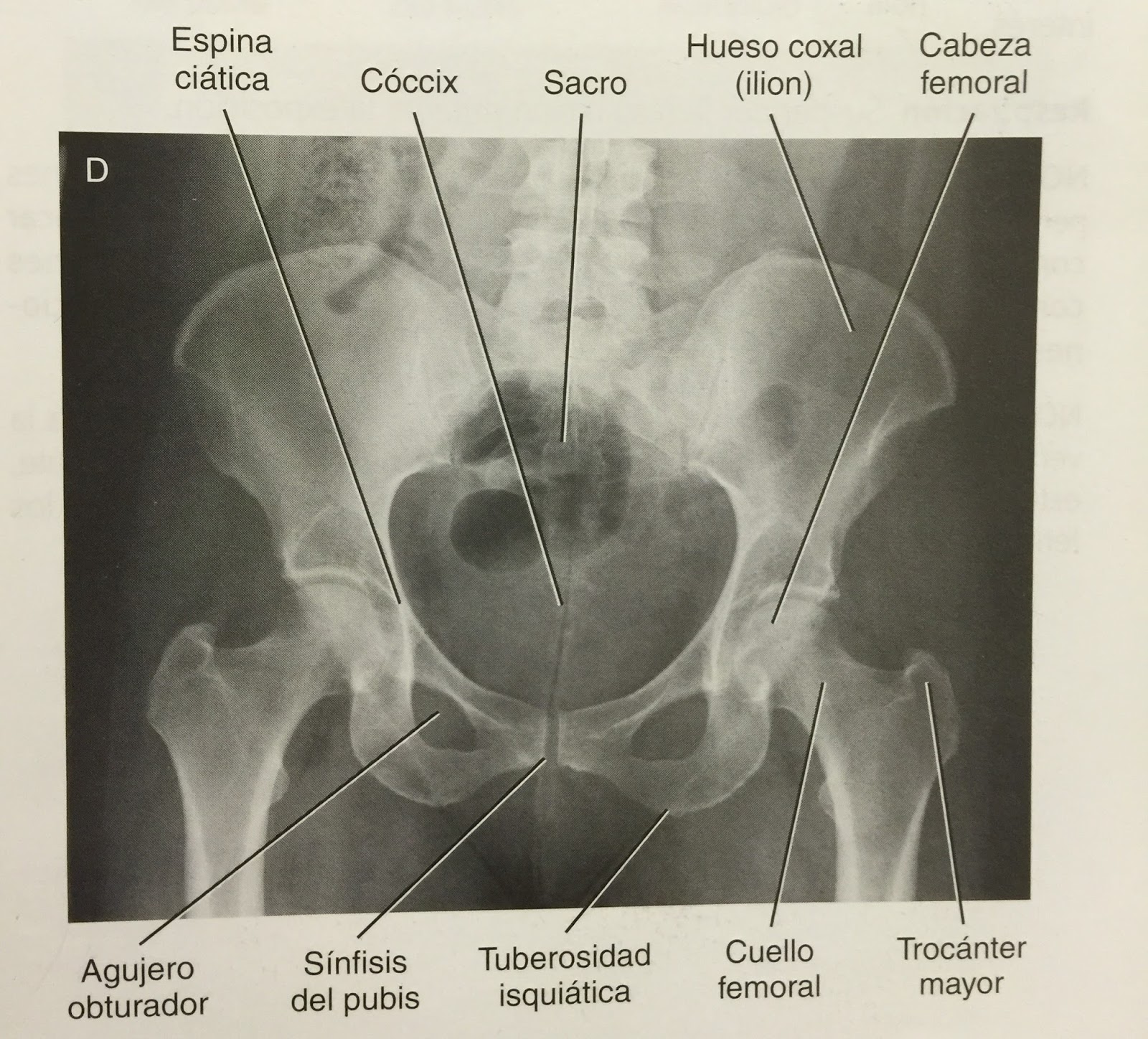 NOSOLOTECNICOS: PELVIS AP