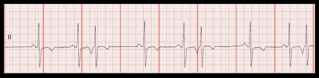 Various Rhythms with PJCs