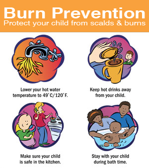Funky Frugal Mommy: Burn Awareness Week is February 5 to 11