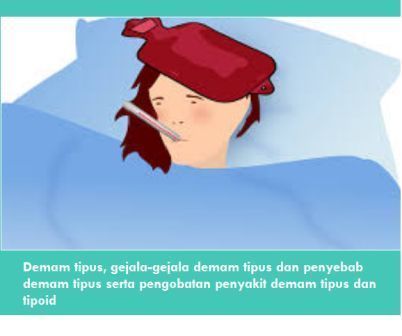 Demam tipus, gejala-gejala demam tipus dan penyebab demam tipus serta ...