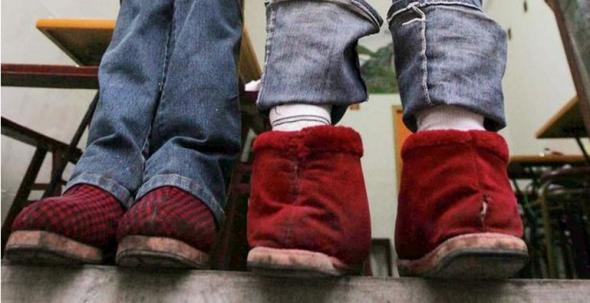 HOT MAGAZINETZ: VIDEO: MIRACLE WOMAN BORN WITH BACKWARD FEET...