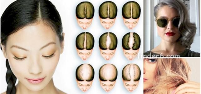 7 Hair conditions and what do they say about your health ...