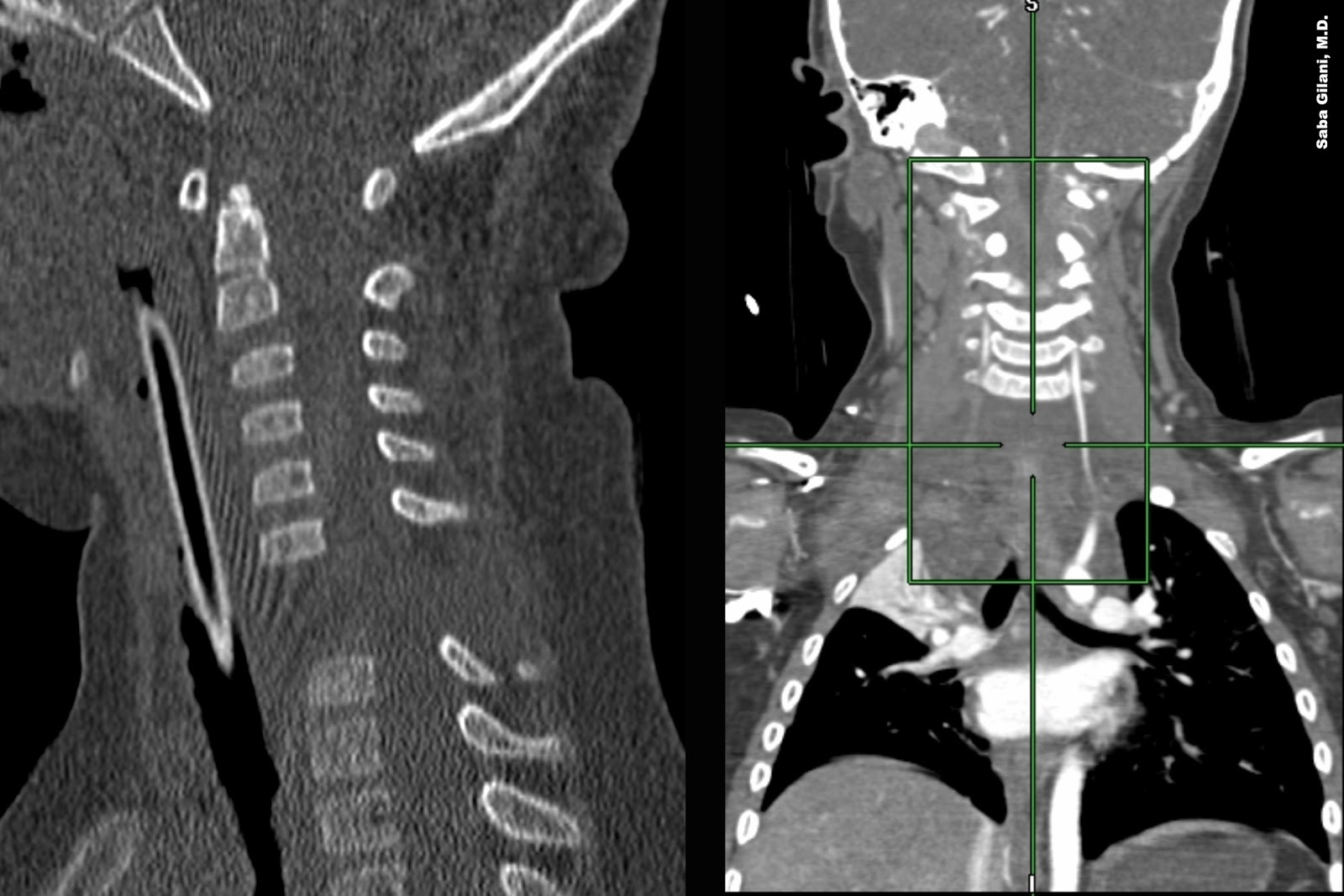 Roentgen Ray Reader: January 2013