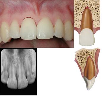 Dentistry lectures for MFDS/MJDF/NBDE/ORE: A Note On Definition ...