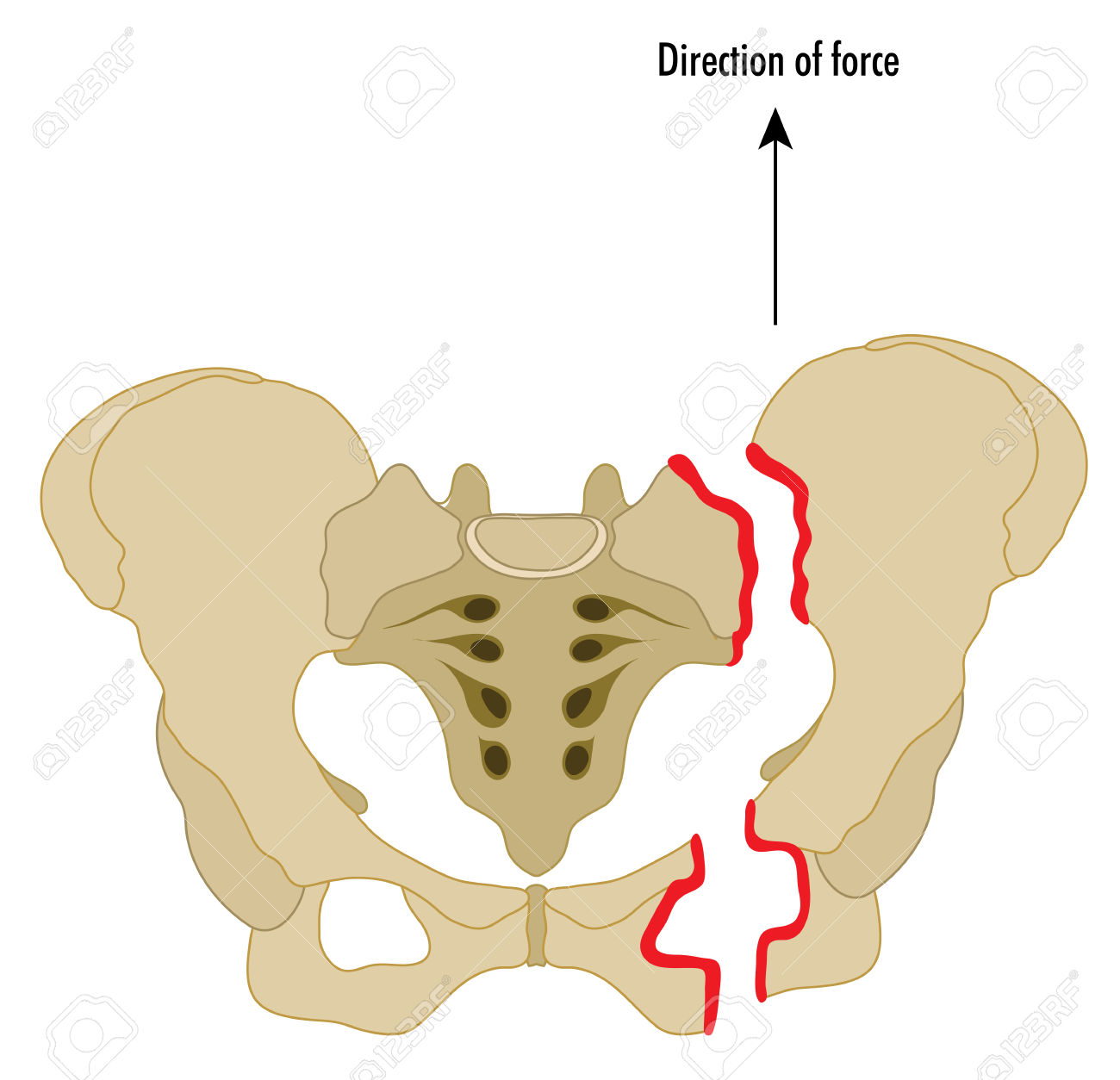EMS SOLUTIONS INTERNATIONAL by @DrRamonReyesMD marca registrada ...