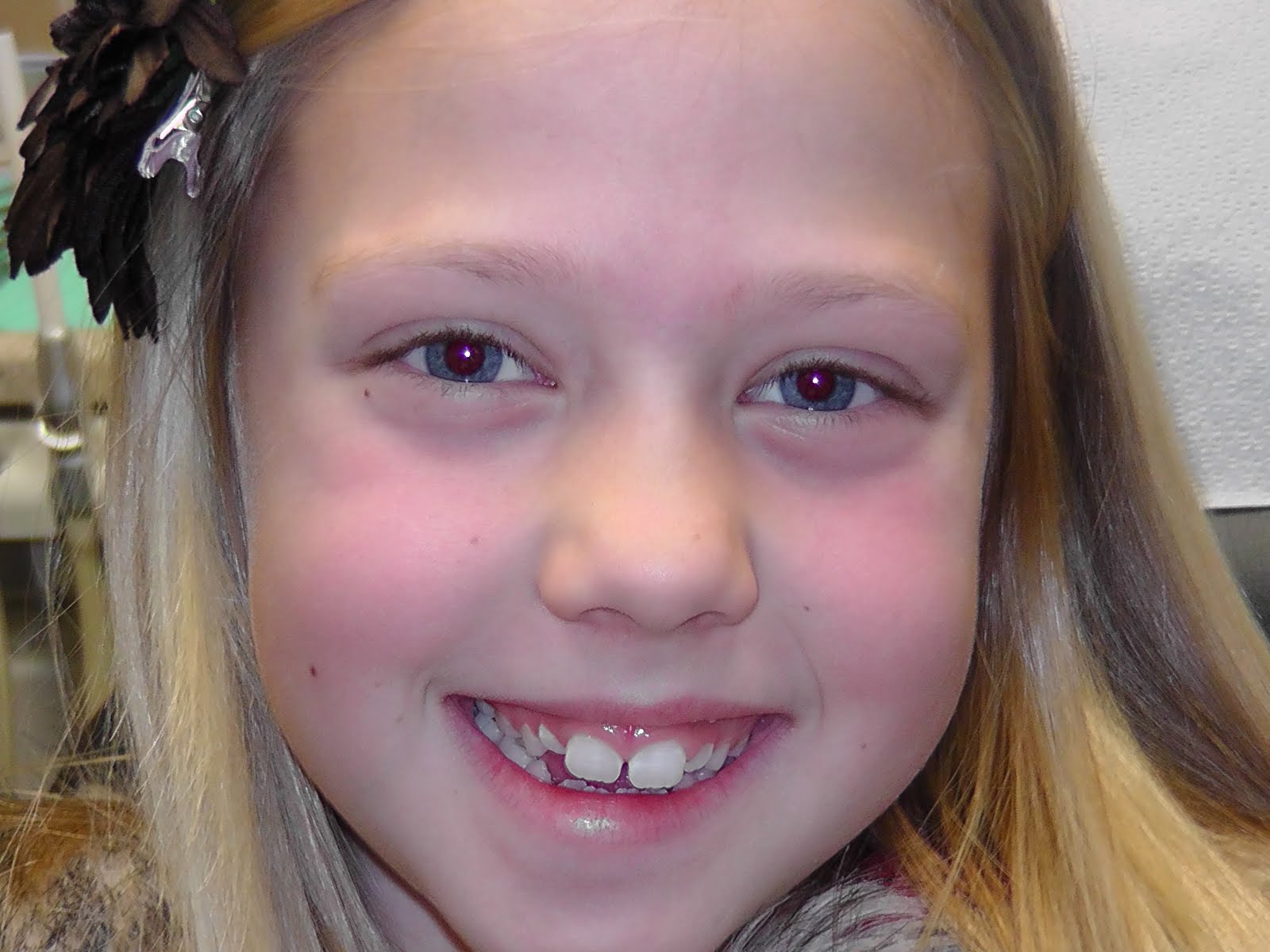 Mom to the 3rd Power: Before~During~After