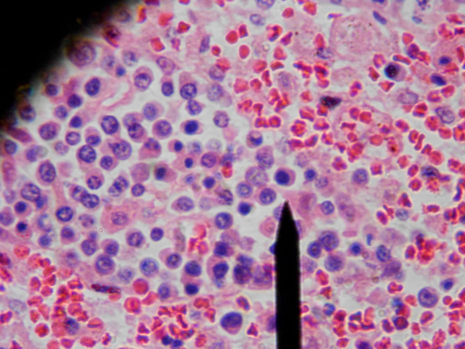 Placas Histologicas : enero 2013