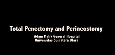 TOTAL PENECTOMY | Sense Heal
