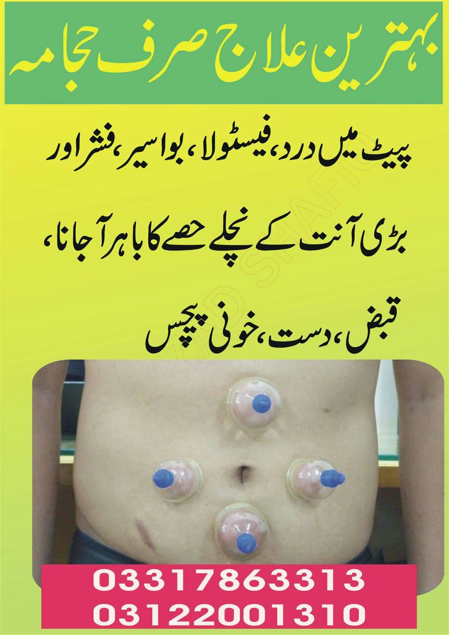 Hijama : Hijama cupping. Hijama centre. Hijama treatment. Hijama in ...