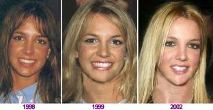 Britney Spears surgery pictures 2011 | Before and After Plastic Surgery ...