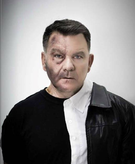 PATRINAKI: ΑΓΡΙΟ ΞΥΛΟ ΣΤΟΝ ΚΟΥΓΙΑ ΣΤΟ ΕΛ. ΒΕΝΙΖΕΛΟΣ