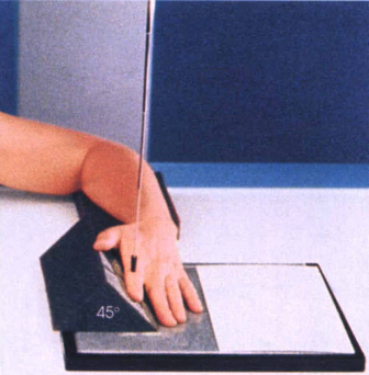 Oblique Position Patient