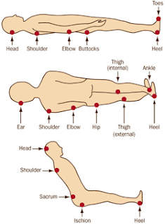 NURSING CARE IN ELDERLY: NURSING APPROACH FOR PRESSURE ULCERS.