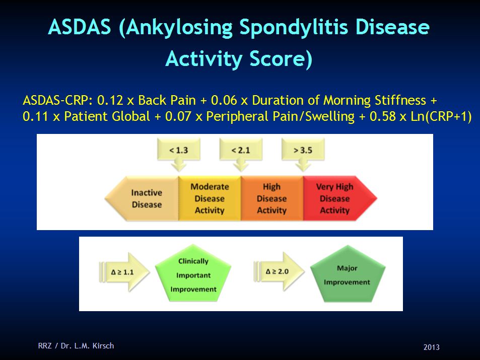 Rheumatologe: M. Bechterew / ankylosierende Spondylitis