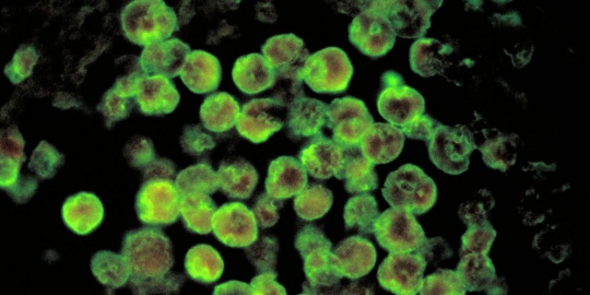 Spesies Bakteri Air Minum | BIOLOGIPEDIA