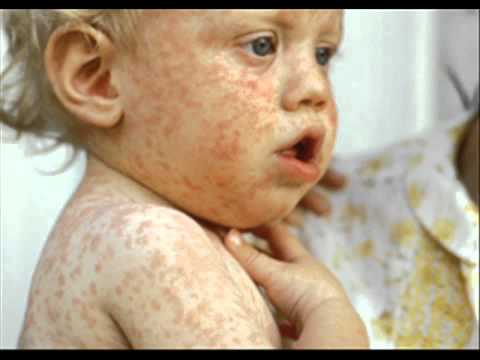 September 2012 | KATUMBU