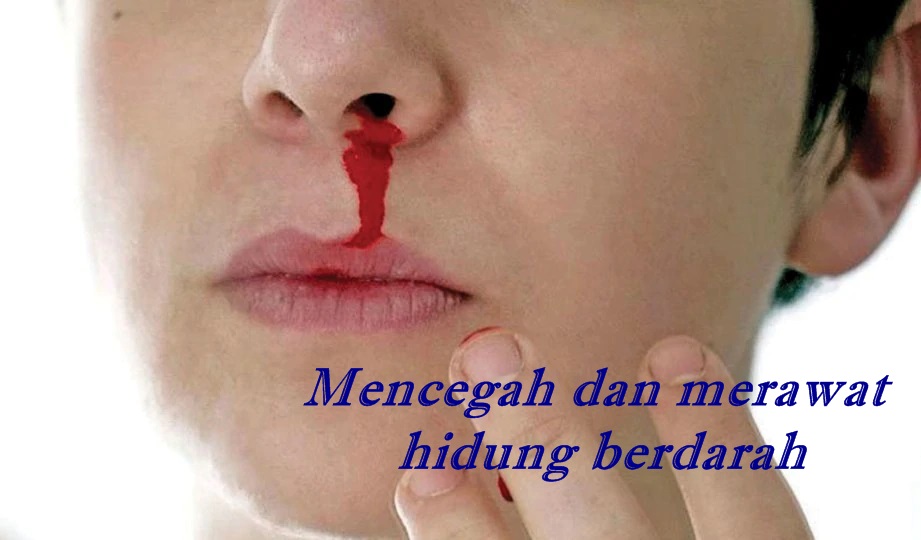 vitamin sana sini : Selsema Punca Hidung Berdarah, Bahaya atau Tidak