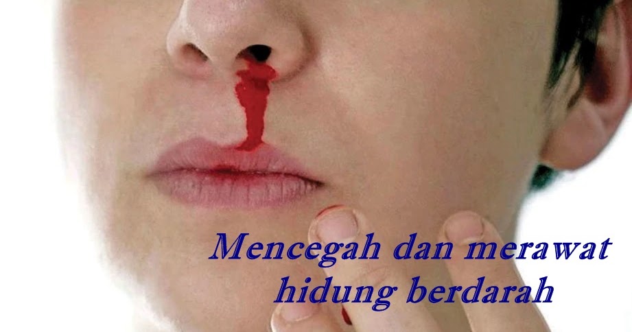 vitamin sana sini : Selsema Punca Hidung Berdarah, Bahaya atau Tidak