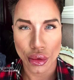 Botched doctors left shocked as man with ''duck' lips wants them bigger ...