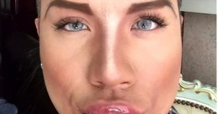 Latest Updates: Botched doctors left shocked as man with ''duck' lips ...