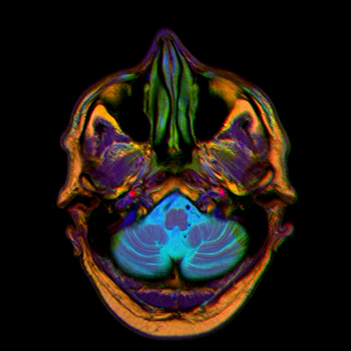 Nevit's blog: Color MRI of the Brain