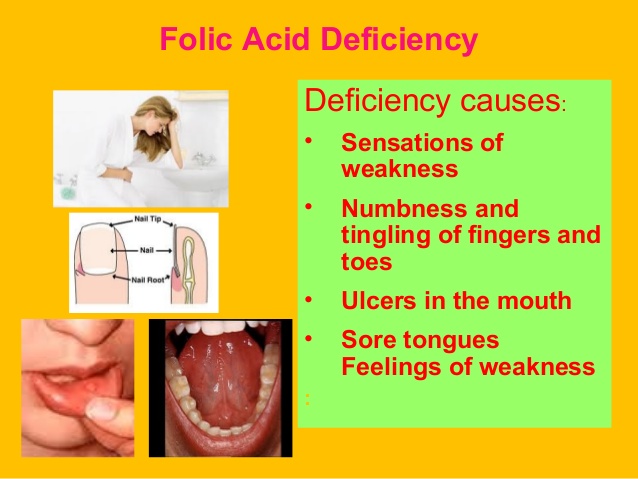Health Information Guide- HELP: Folic Acid Deficiency Anemia