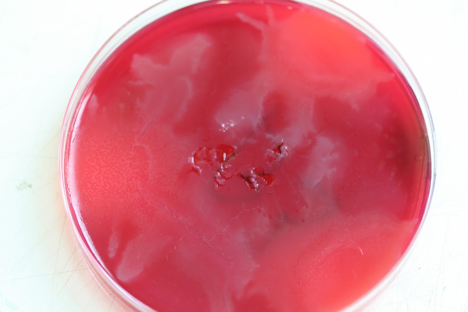 LABORATORIO Y MICROBIOLOGÍA: FOTOS DE GÉNERO SALMONELLA EN MEDIO SMS.