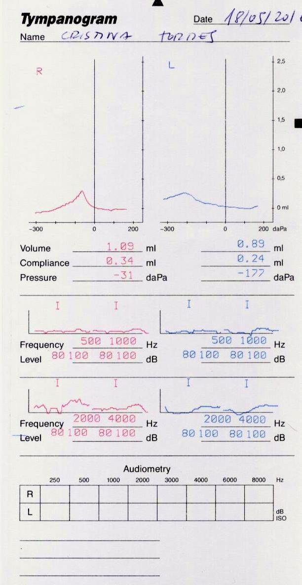 E.O.E. ESPECIALIZADO DIVERSIDAD FUNCIONAL AUDITIVA (GRANADA) : 2016