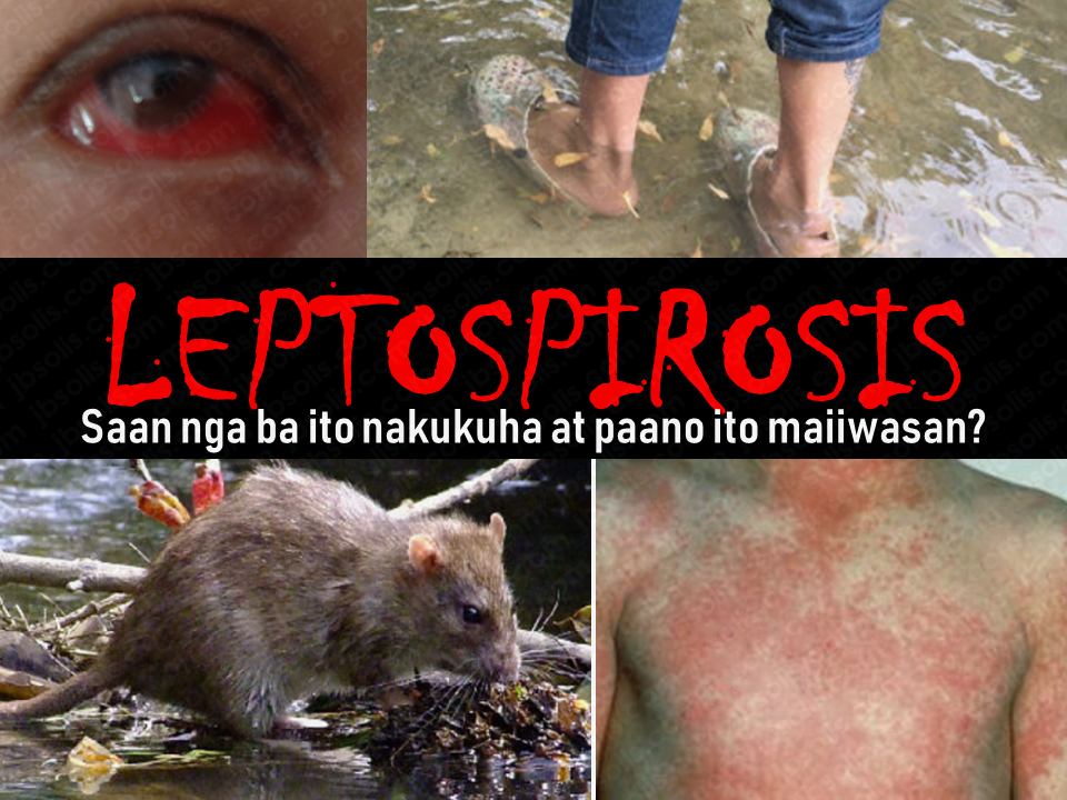 Leptospirosis Awareness, Causes And Prevention