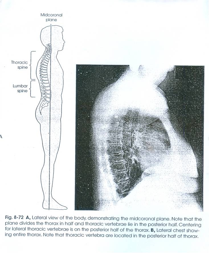 TEKNIK RADIOGRAFI THORACAL: TEKNIK RADIOGRAFI THORACAL