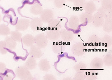 Infection Landscapes: Trypanosomiasis Part 1: Sleeping Sickness