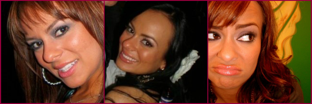 Tanorexic Before And After