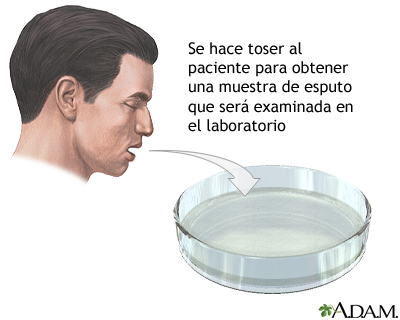 Biología Molecular : Prueba de tamizaje y confirmatoria para Tuberculosis