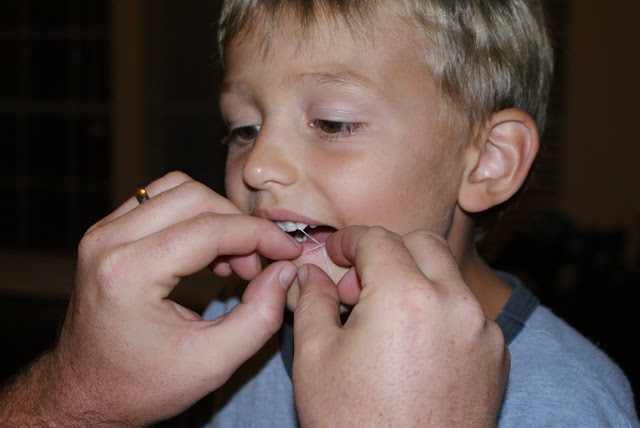 For The Luv Of Boys: How NOT to Pull a Tooth - a Bad Tutorial