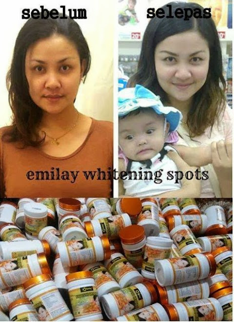 Damia De'noorish Elegance (D.N.E) : Emilay Whitening Softgel Malaysia