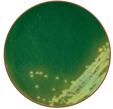 [Microbiology] TCBS Agar | Free Medical Atlas
