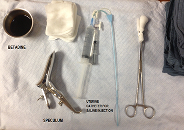 Pengalaman HSG (Histerosalpingografi) & Tes Darah (Cek Progesterone dan ...