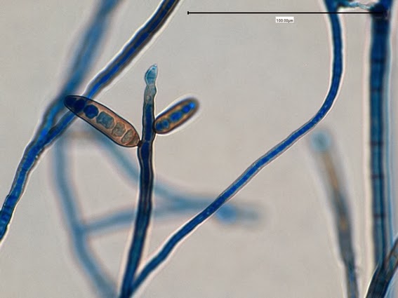 Fun With Microbiology (What's Buggin' You?): October 2013