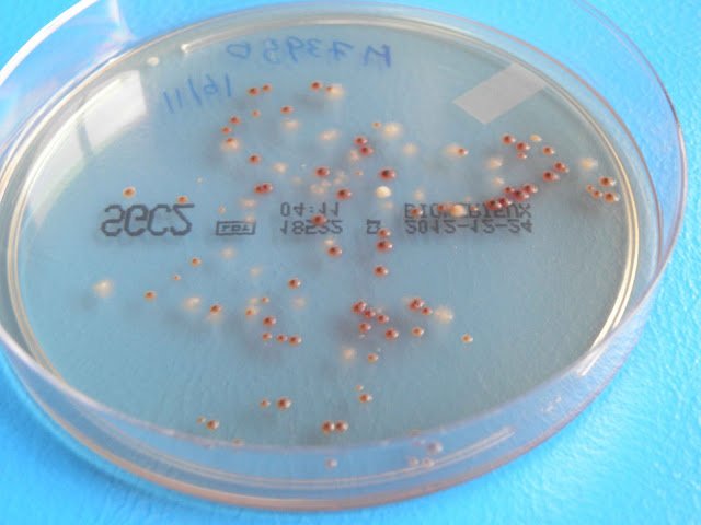 ATLAS MICOLOGIA: TRICHOPHYTON VIOLACEUM