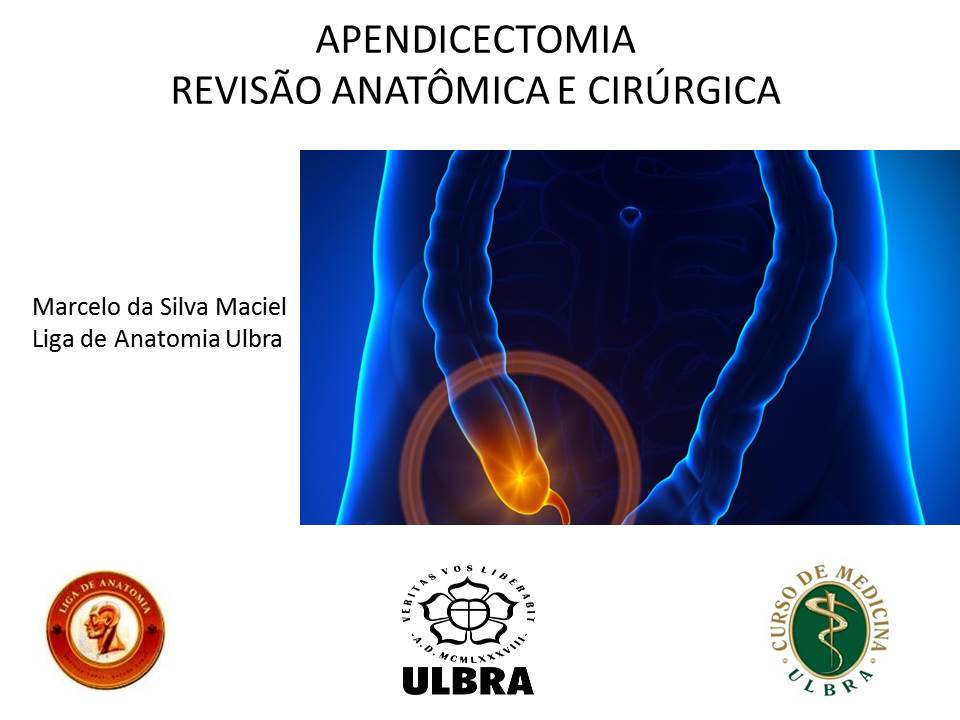 Liga de Anatomia ULBRA: APENDICECTOMIA: REVISÃO ANATÔMICA E CIRÚRGICA