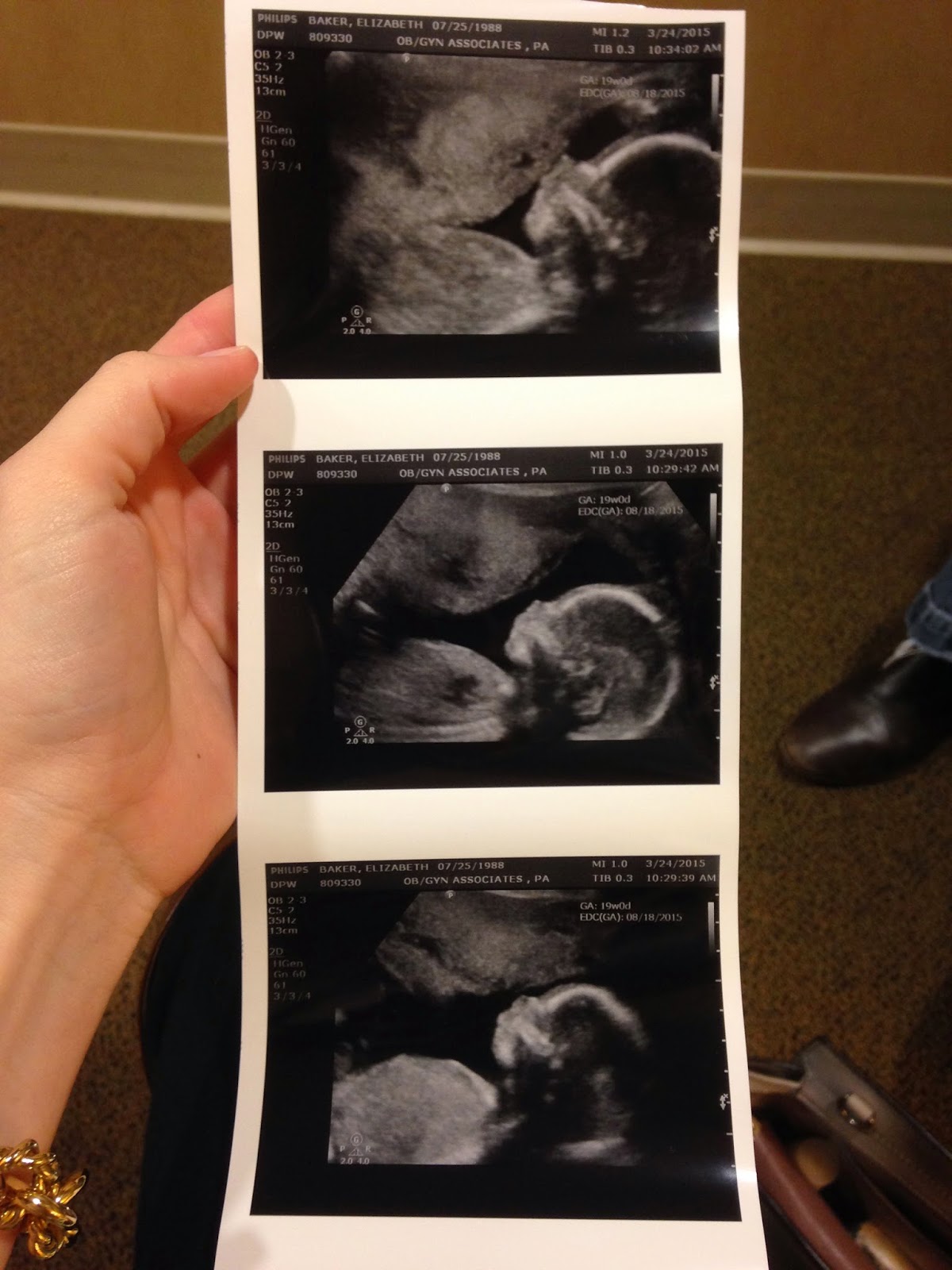 Anatomy Scan: 19 Weeks | Bad Cook, Great Baker